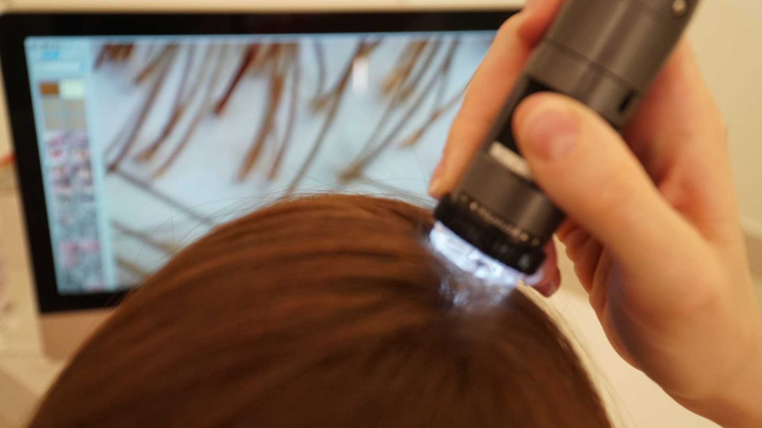 Tricologia e Terapia Capilar - Renew Academy